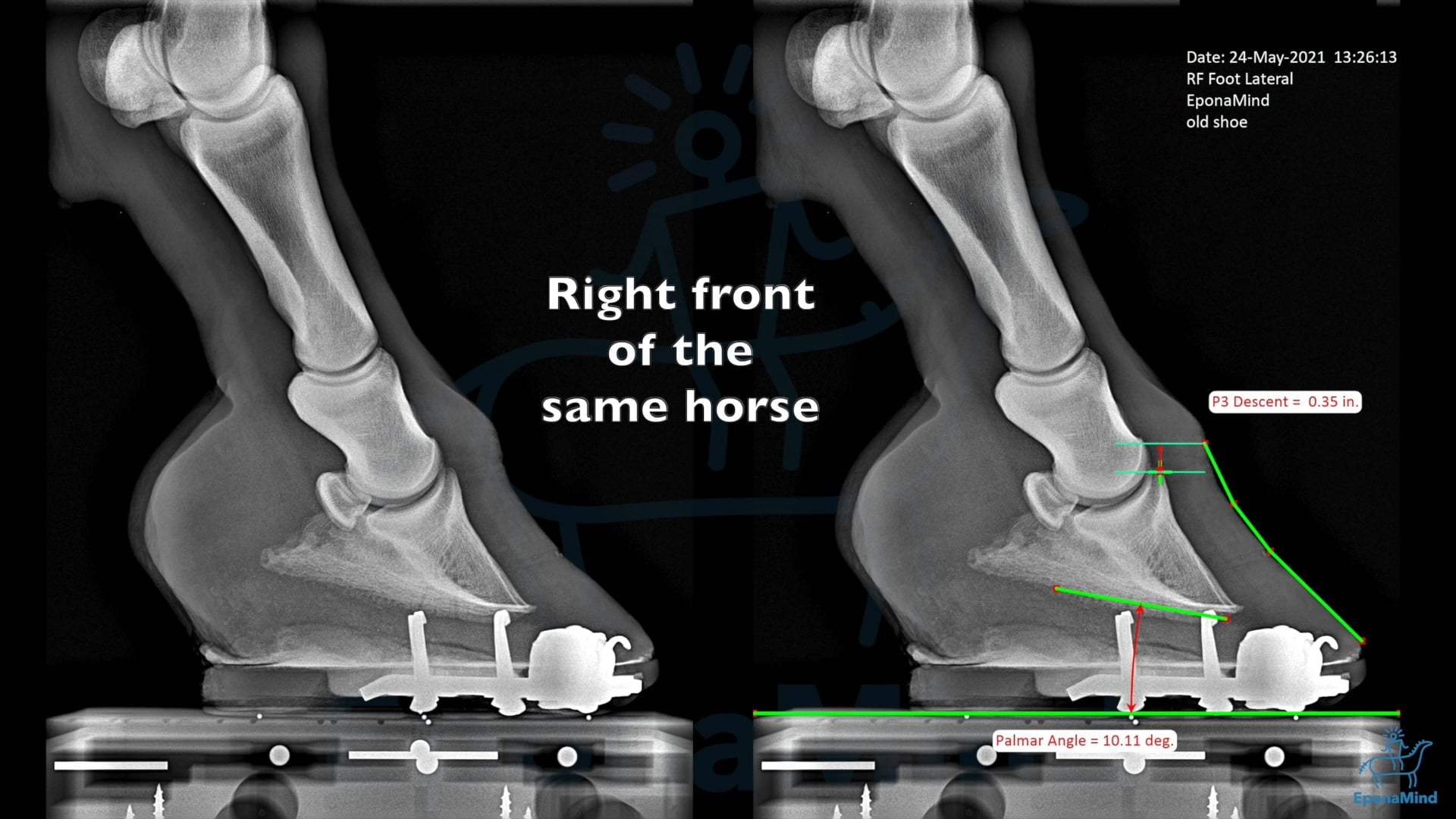 Demineralized Pedal Bones in a Competition Horse on Vimeo