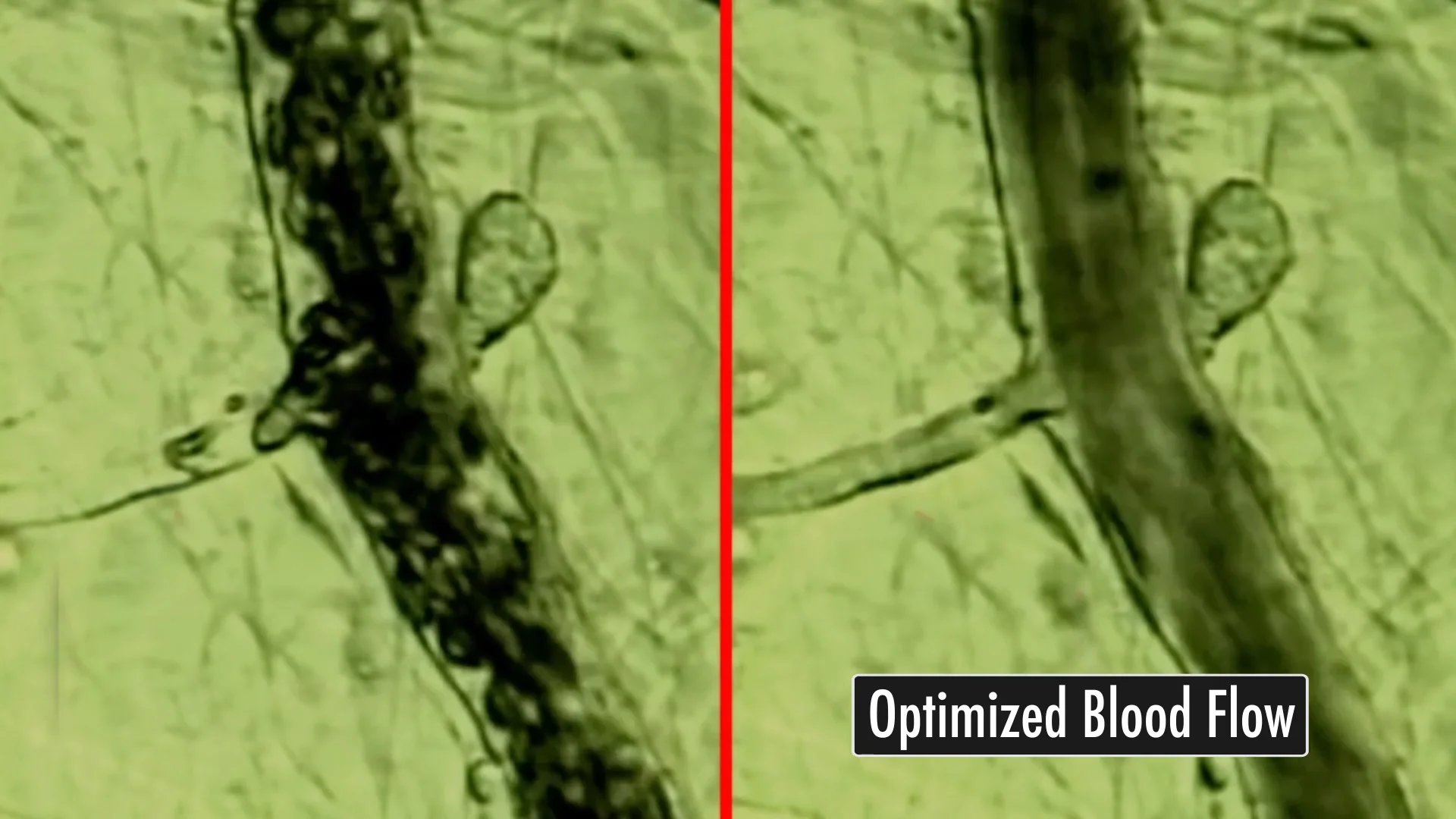 BEMER Blood Flow vid on Vimeo