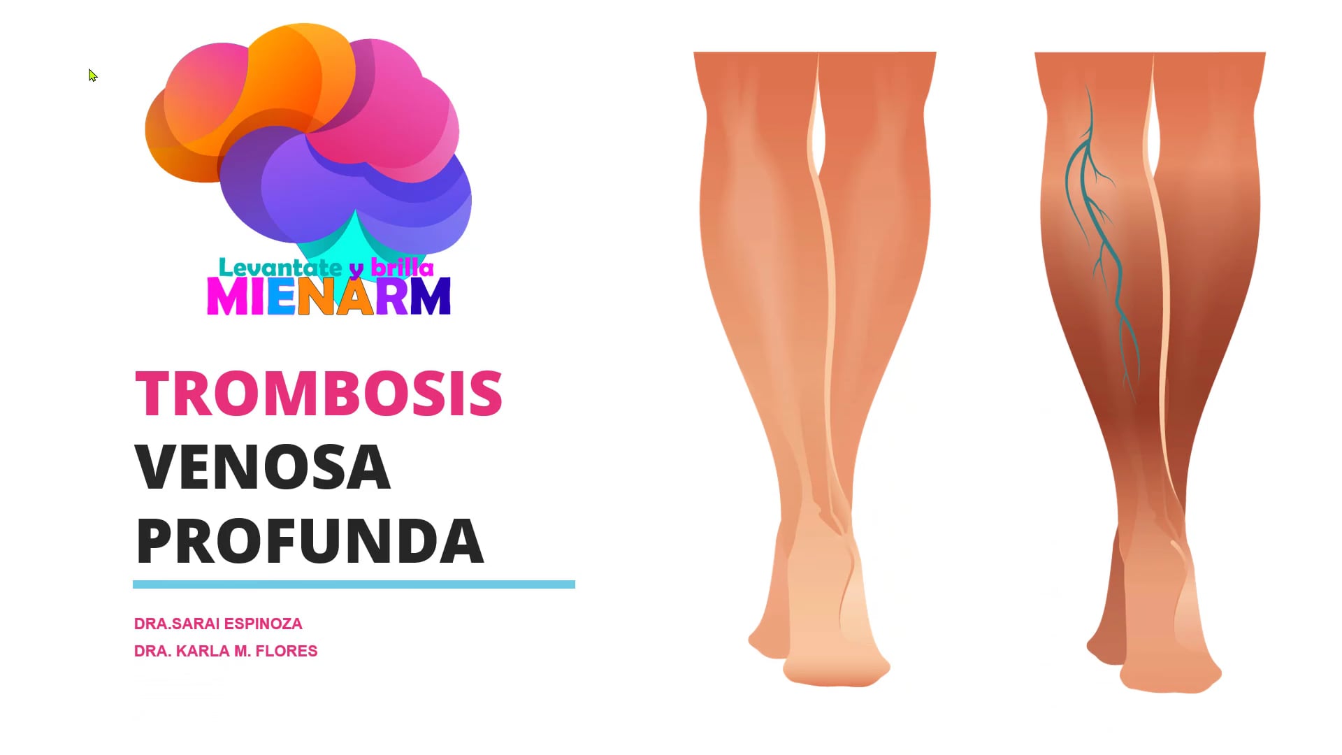 TROMBOSIS VENOSA PROFUNDA on Vimeo