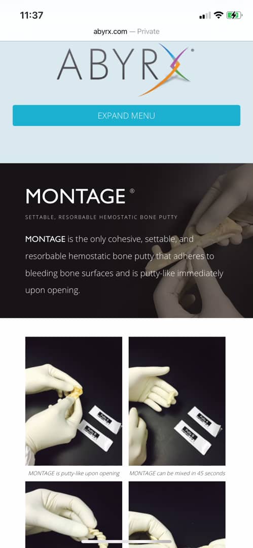 ABYRX - Montage Bone Putty on Vimeo