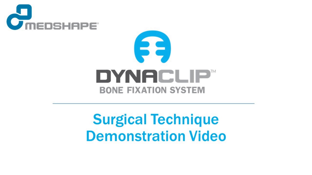 DynaClip® Bone Fixation System - Surgical Technique Demonstration on Vimeo