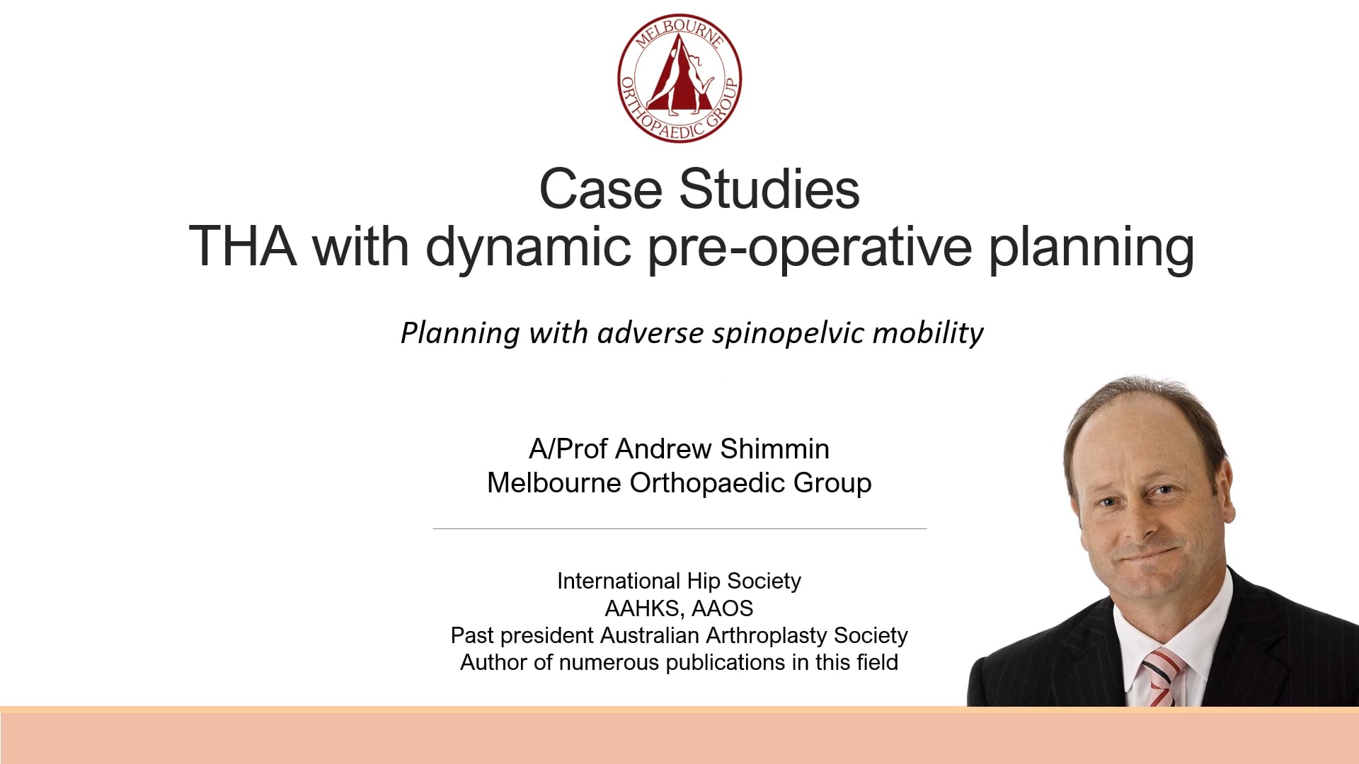 Planning with OPSInsight: Adverse Spinopelvic Mobility with A/Prof ...