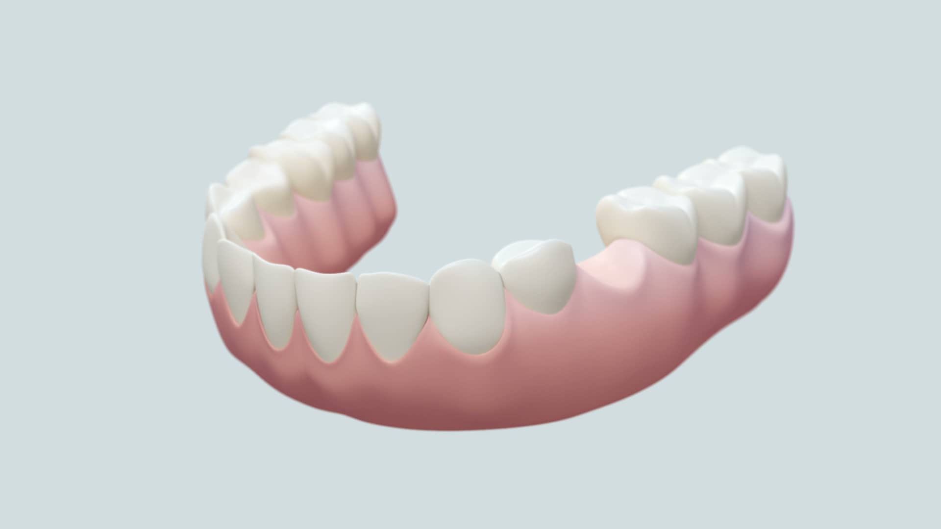 6270008-hd-Dental Implant Bright. High quality animation 3D showing the ...