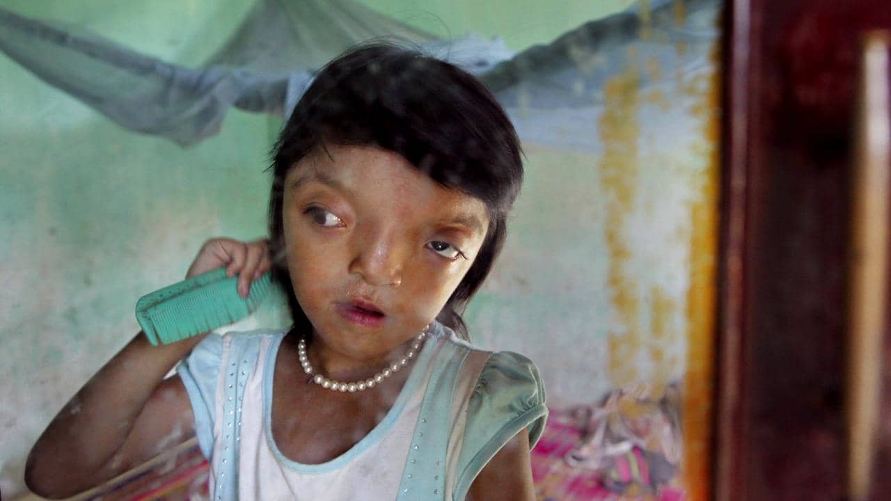 Agent Orange: A Terrible Legacy, photography by Catherine Karnow on Vimeo