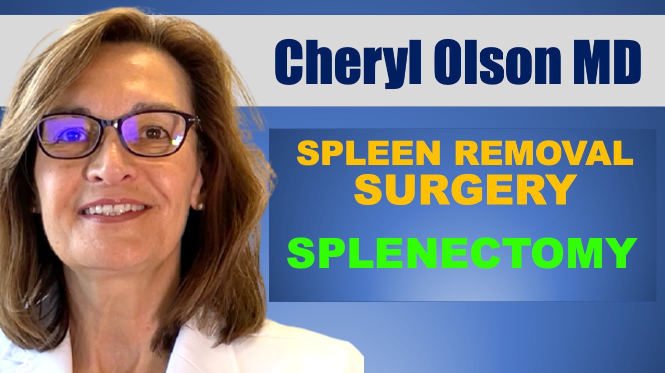 Surgical Associates Video Library - Spleen Removal Surgery (Splenectomy ...