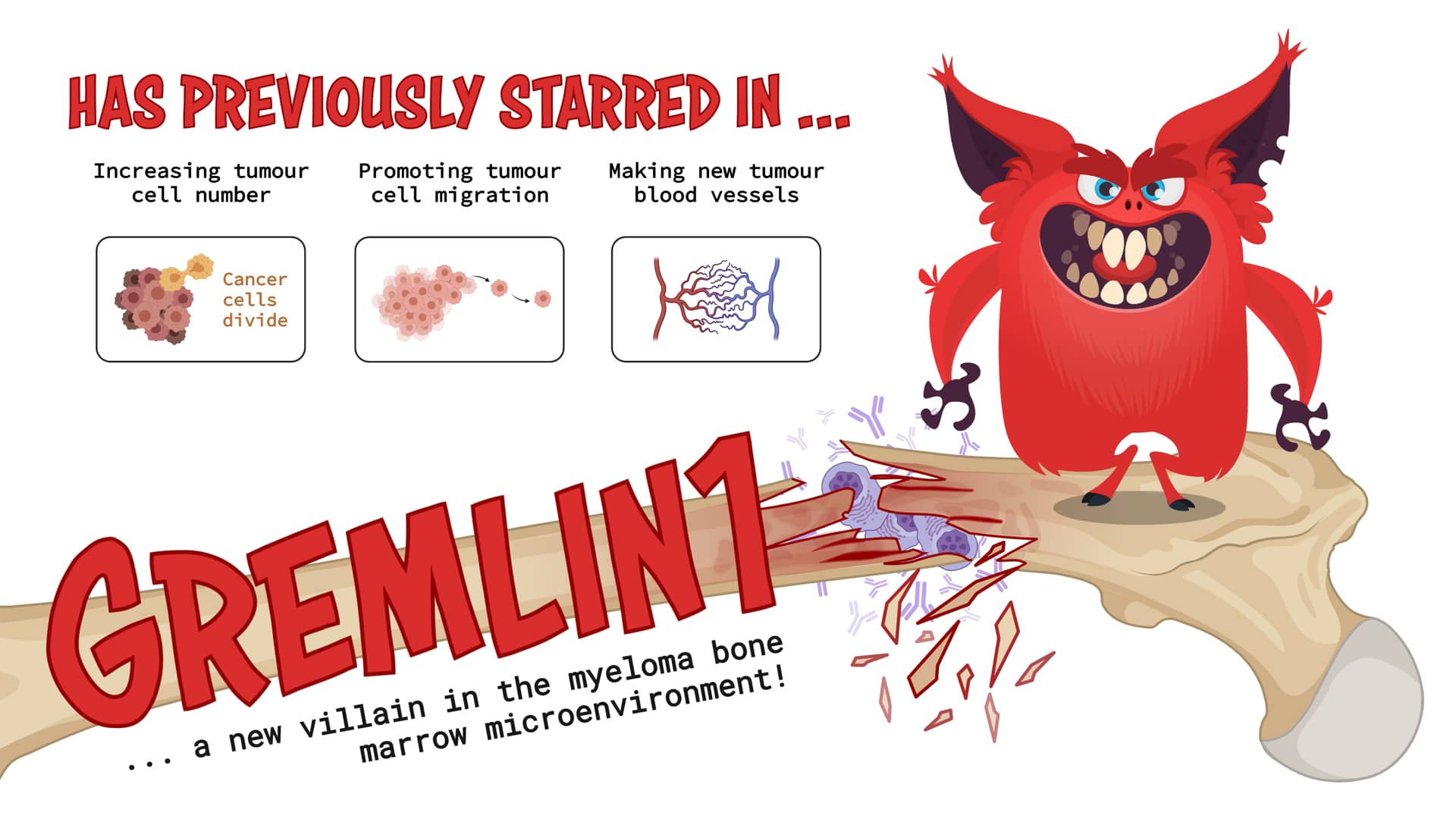 Emma Cheney - Gremlin1: A new villain in the multiple myeloma bone ...