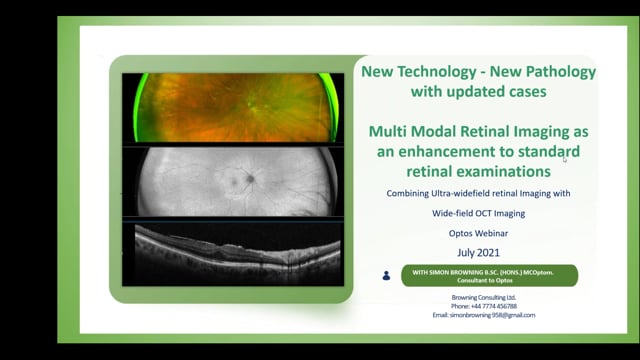 Optos Webinars