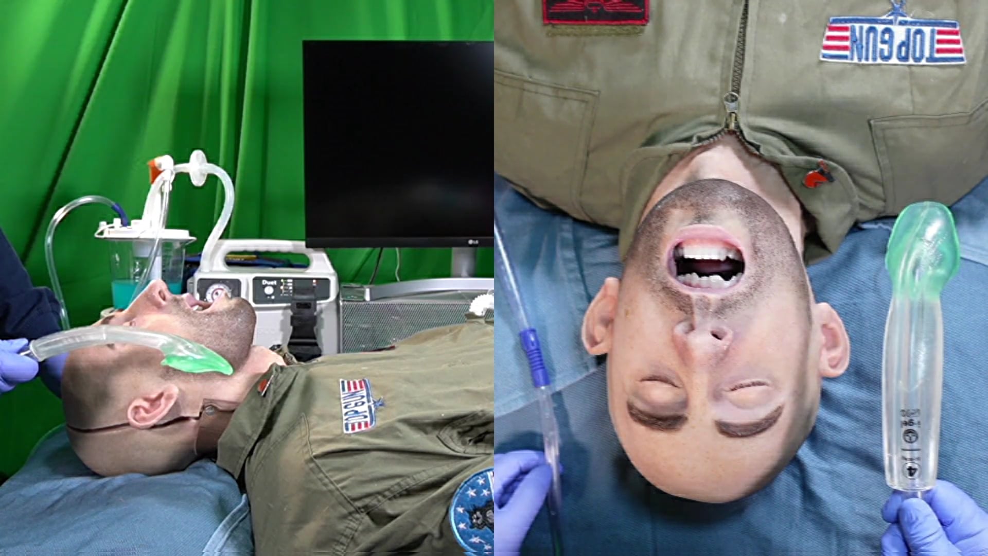 Introduction to the Suction Assisted iGel Insertion method and the use ...