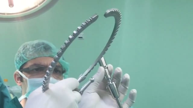 Table Mounted Retractors – Mediflex Surgical Products