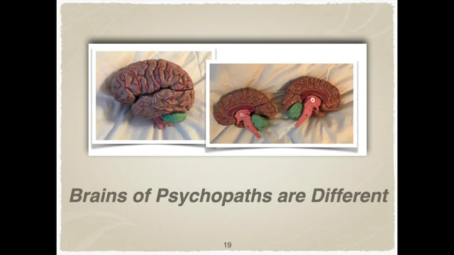 Psychopaths Brain