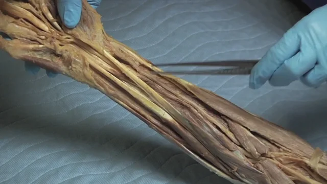 Flexor Digitorum Superficialis Cadaver