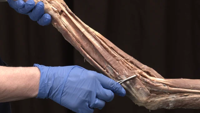 Forearm Muscles Cadaver