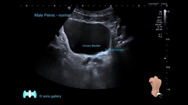 normal Archives - SONO.GALLERY