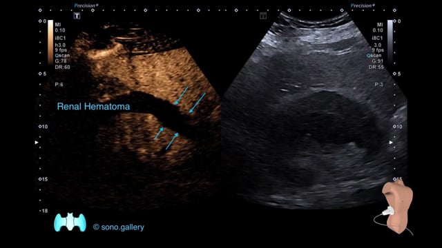 SONO.GALLERY - Page 3 of 122