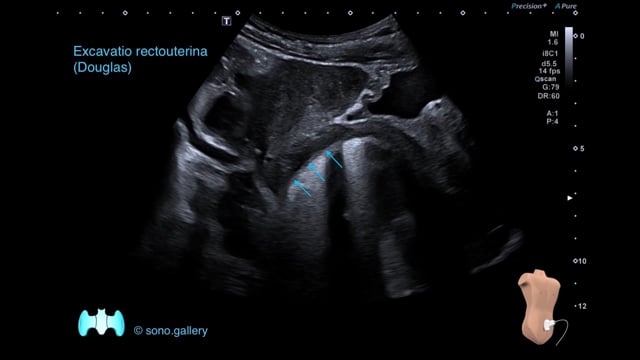 normal Archives - SONO.GALLERY