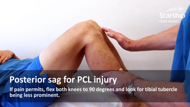 Posterior Sag Test
