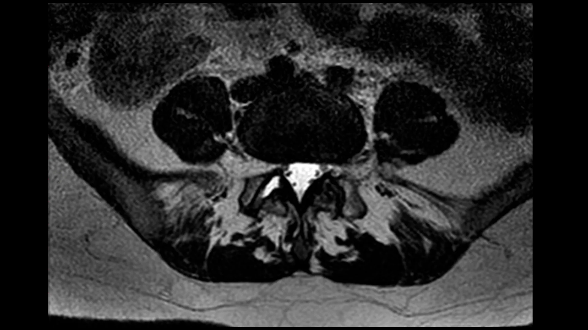 Reading an MRI on Vimeo