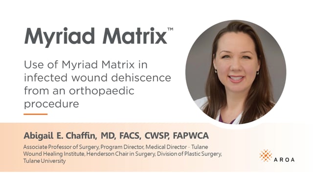 Myriad Matrix™ | AROA