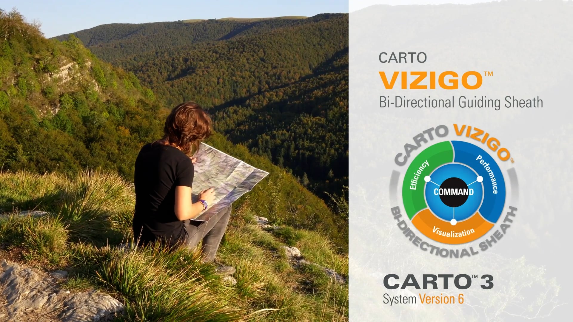 Biosense Carto Vizigo.mp4 on Vimeo