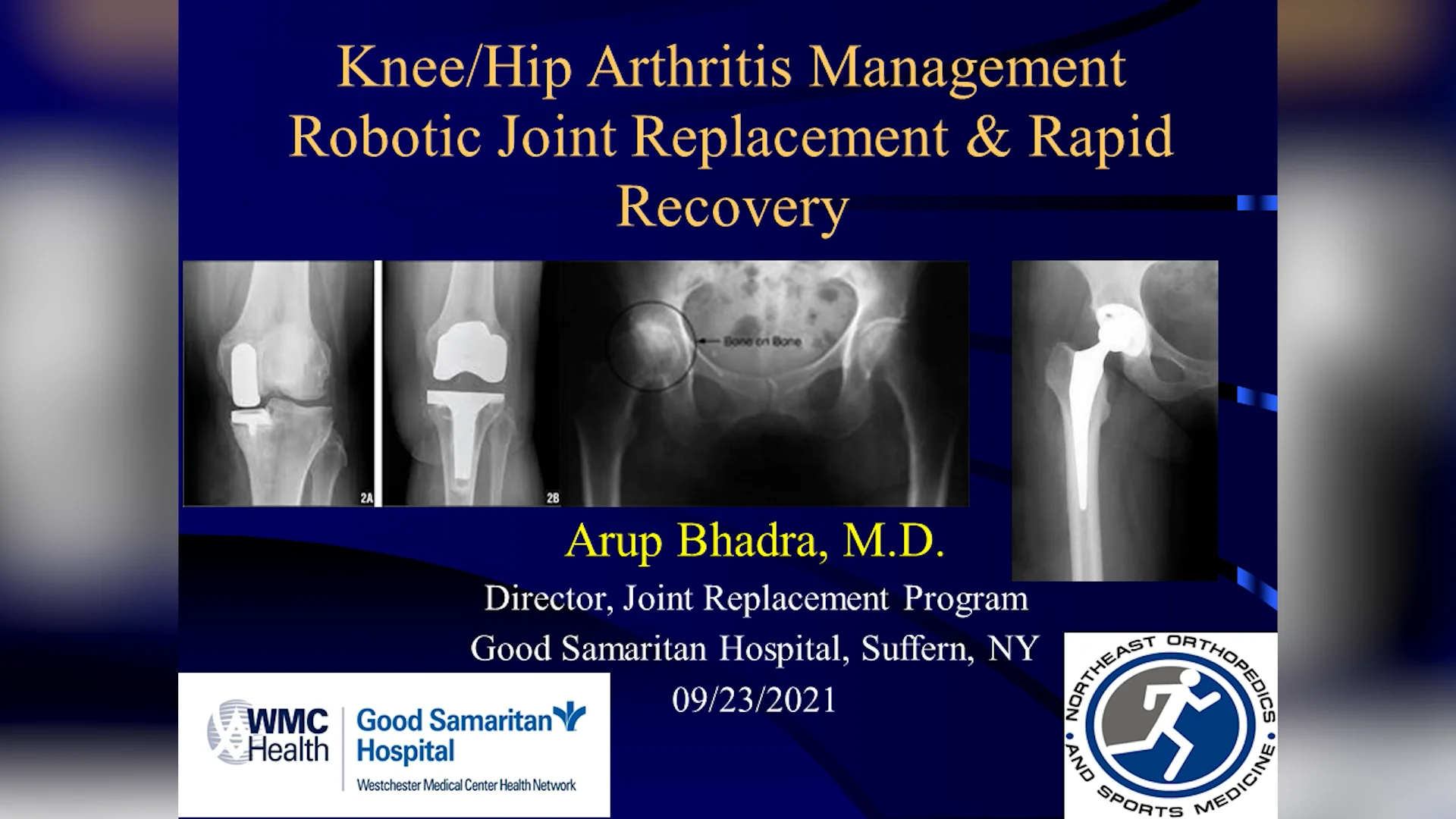 Good Samaritan Hospital Total Joint Replacement Program Presentation on ...