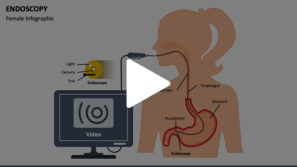 Endoscopy Animated Presentation - SketchBubble on Vimeo