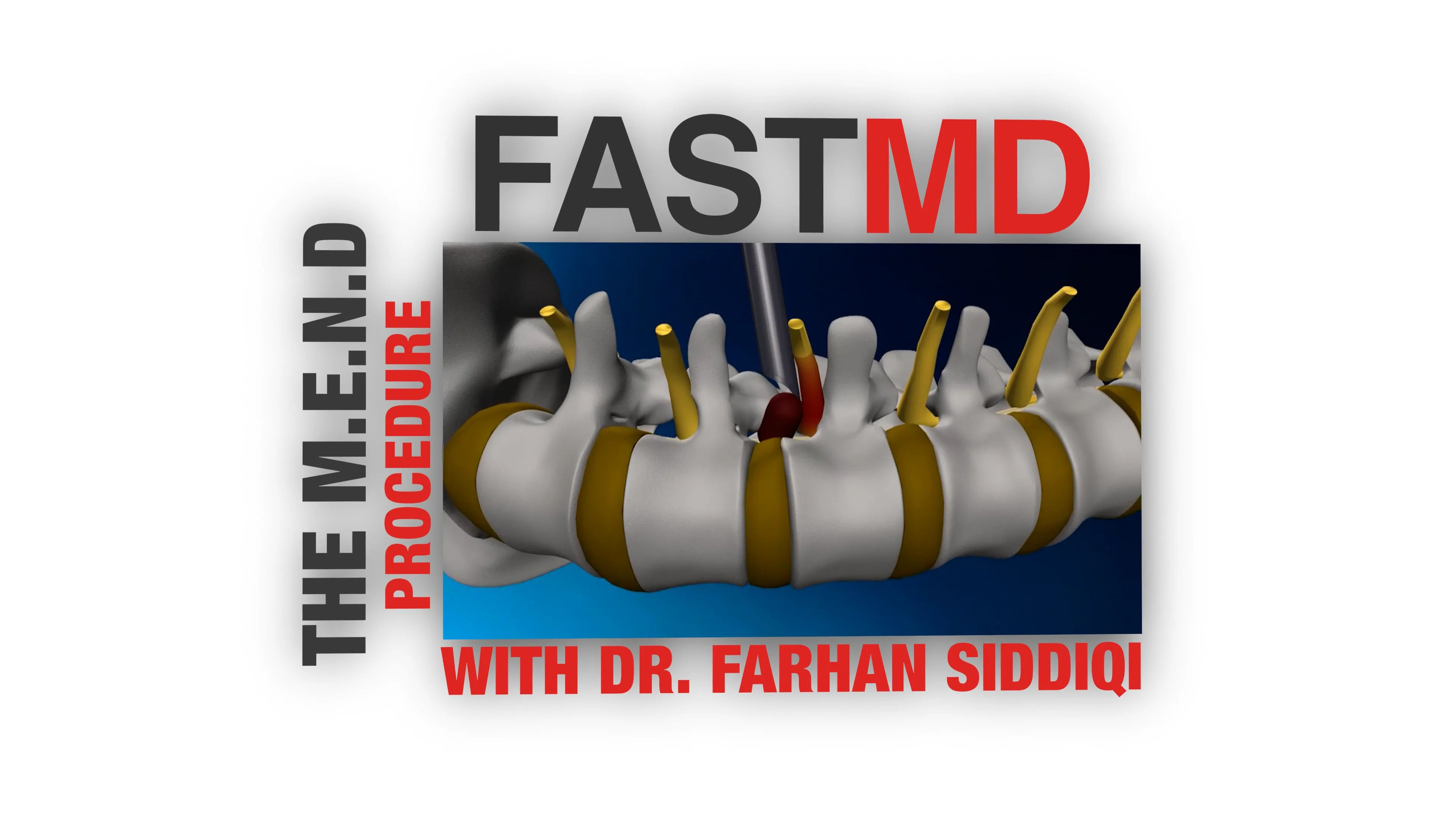 FAST MD MEND
