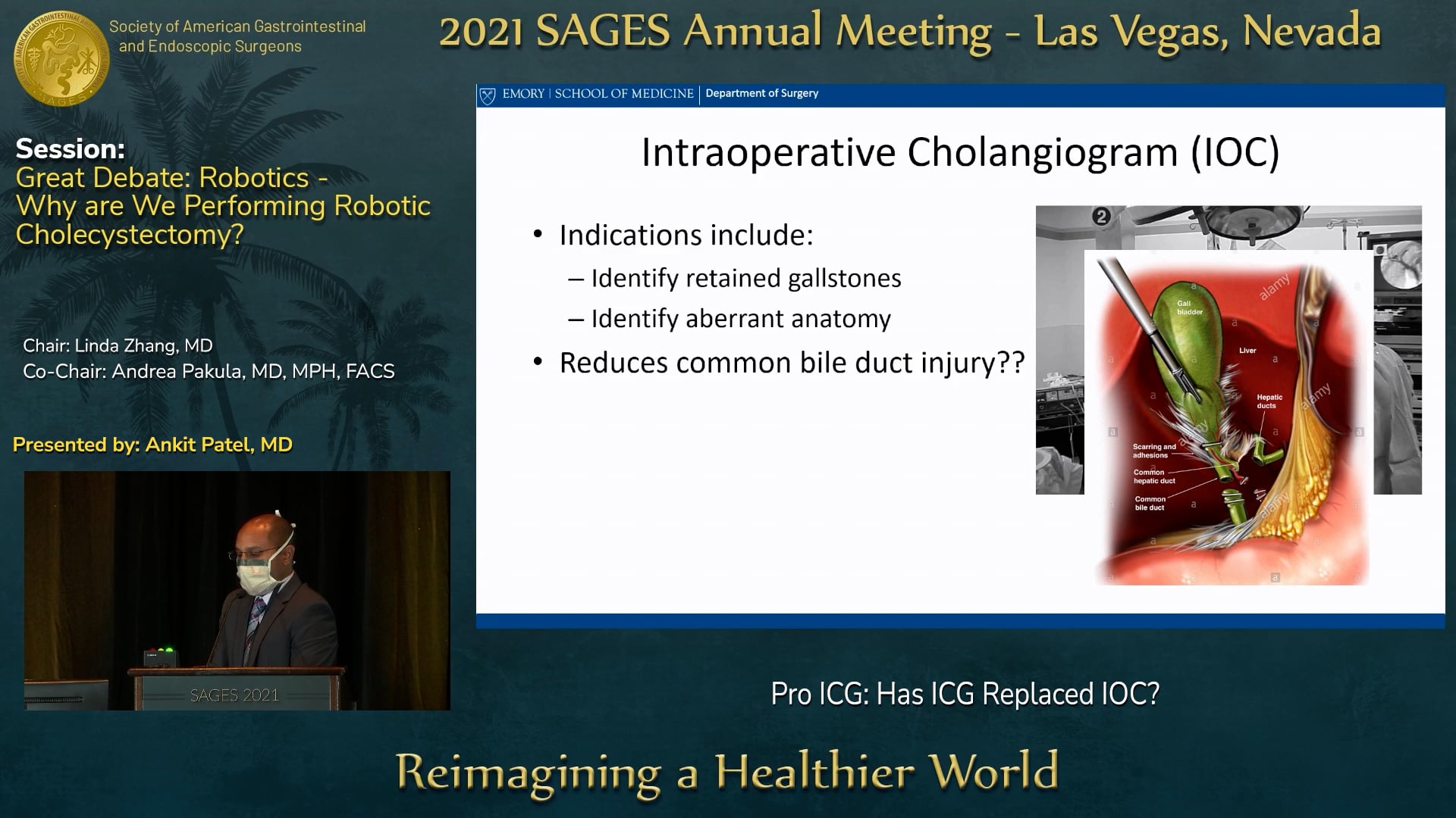 Pro ICG: Has ICG Replaced IOC? Pro IOC: Has ICG Replaced IOC? on Vimeo