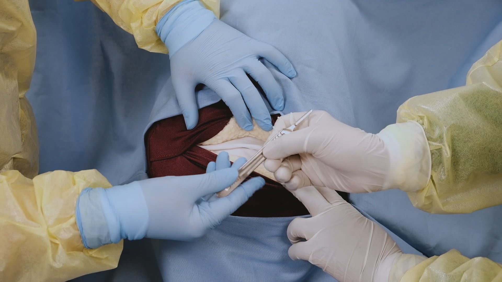 MamaBirthie CS - Cesarean Section on Vimeo
