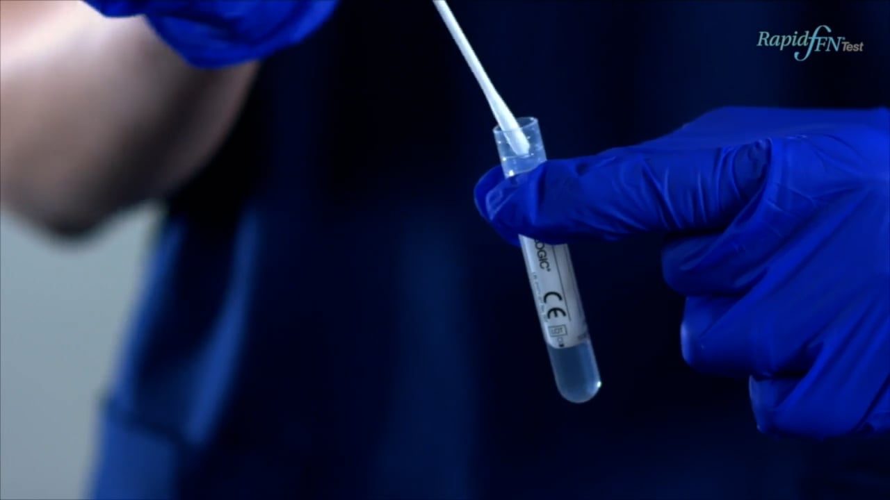Rapid fFN Testing – Collection and analysis on Vimeo