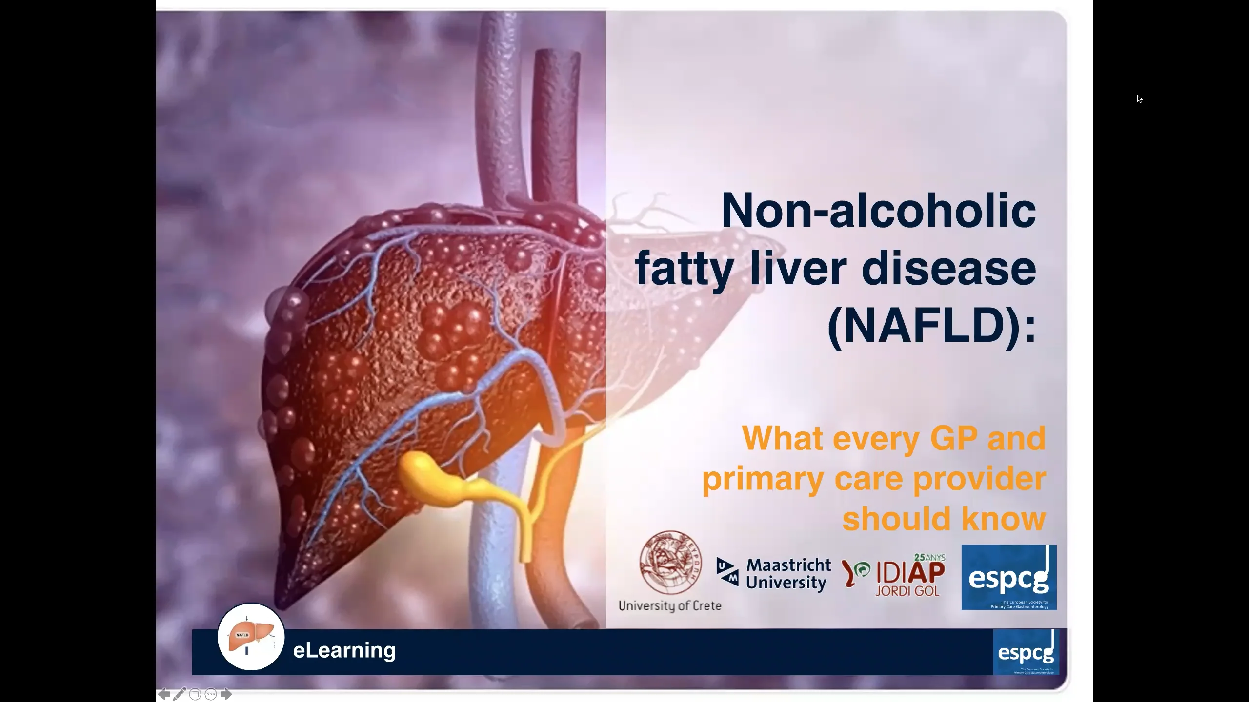 NAFLD Introduction part 1 on Vimeo