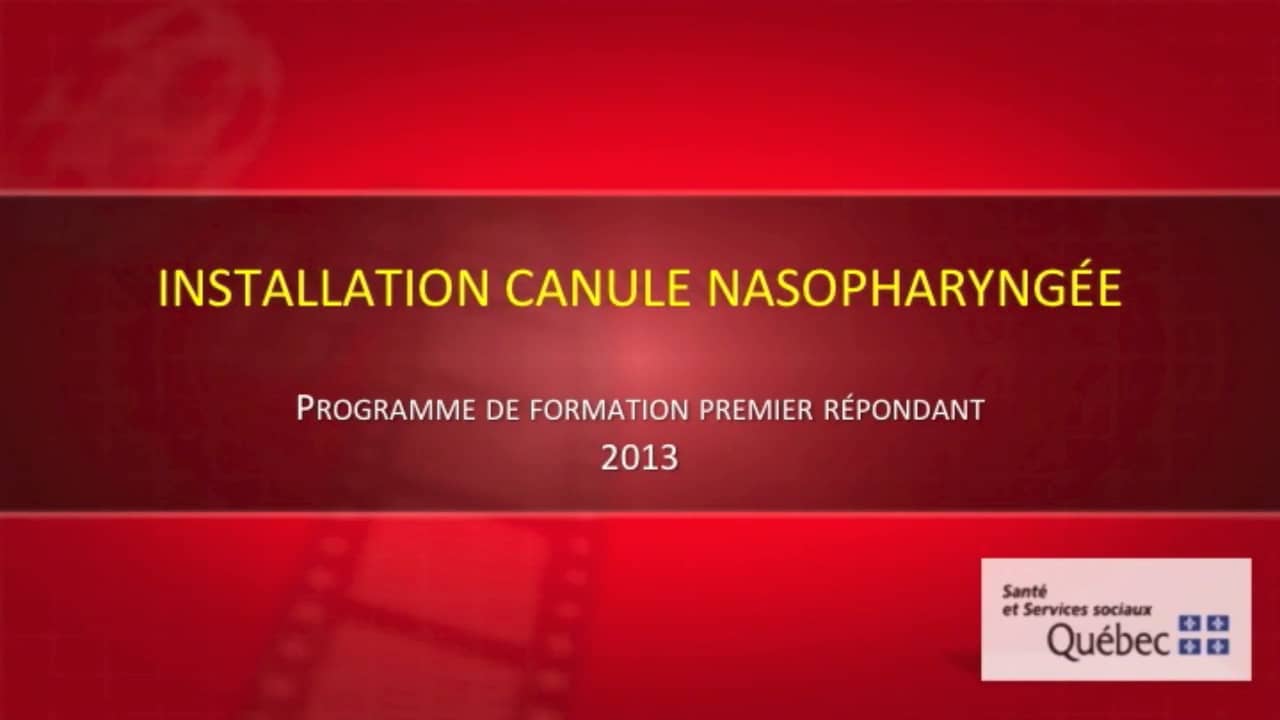 Insertion de la canule nasopharyngée on Vimeo