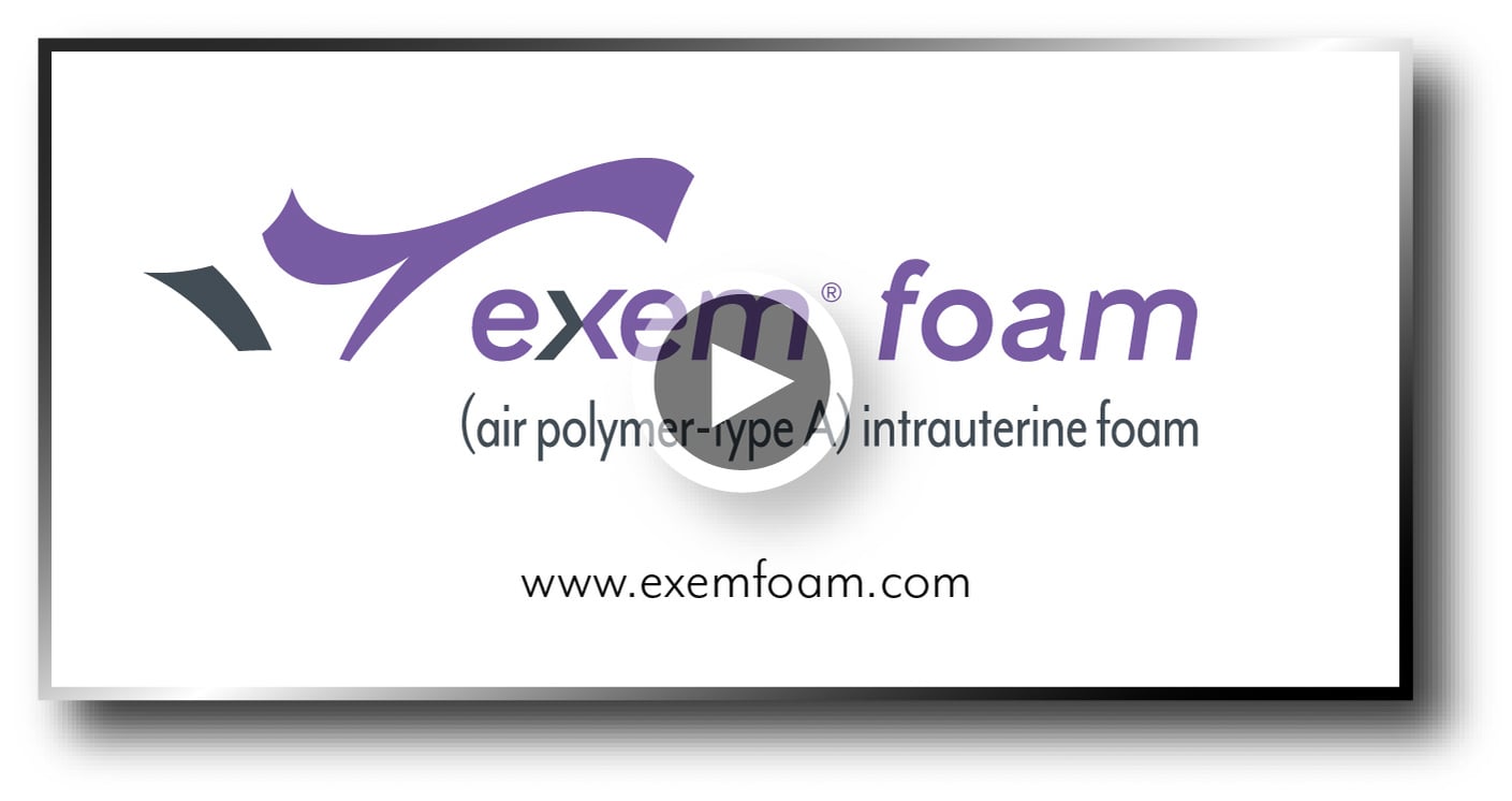 The ExEm® Foam Procedure on Vimeo
