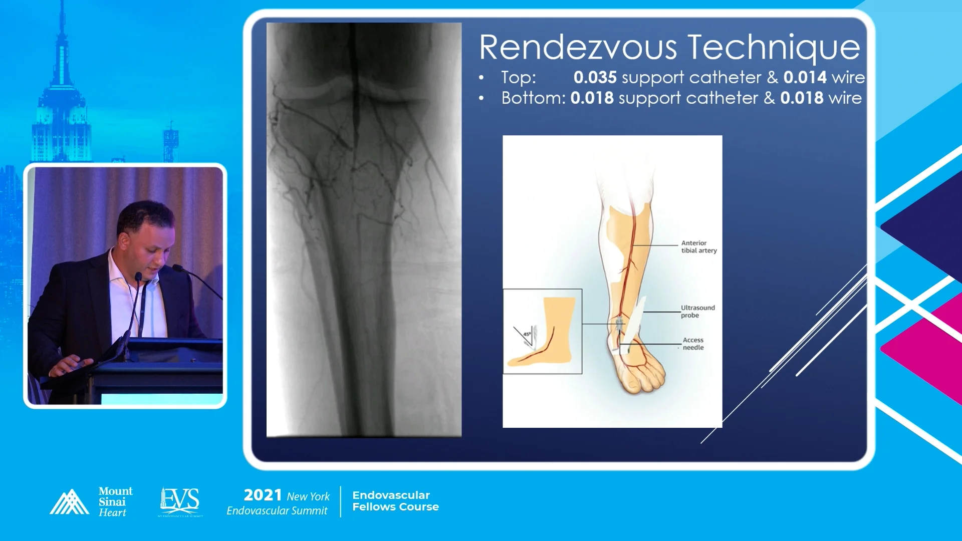 4h05pm - EVS Fellows October 14 2021 - Case Presentation 1 - Shadi Al ...