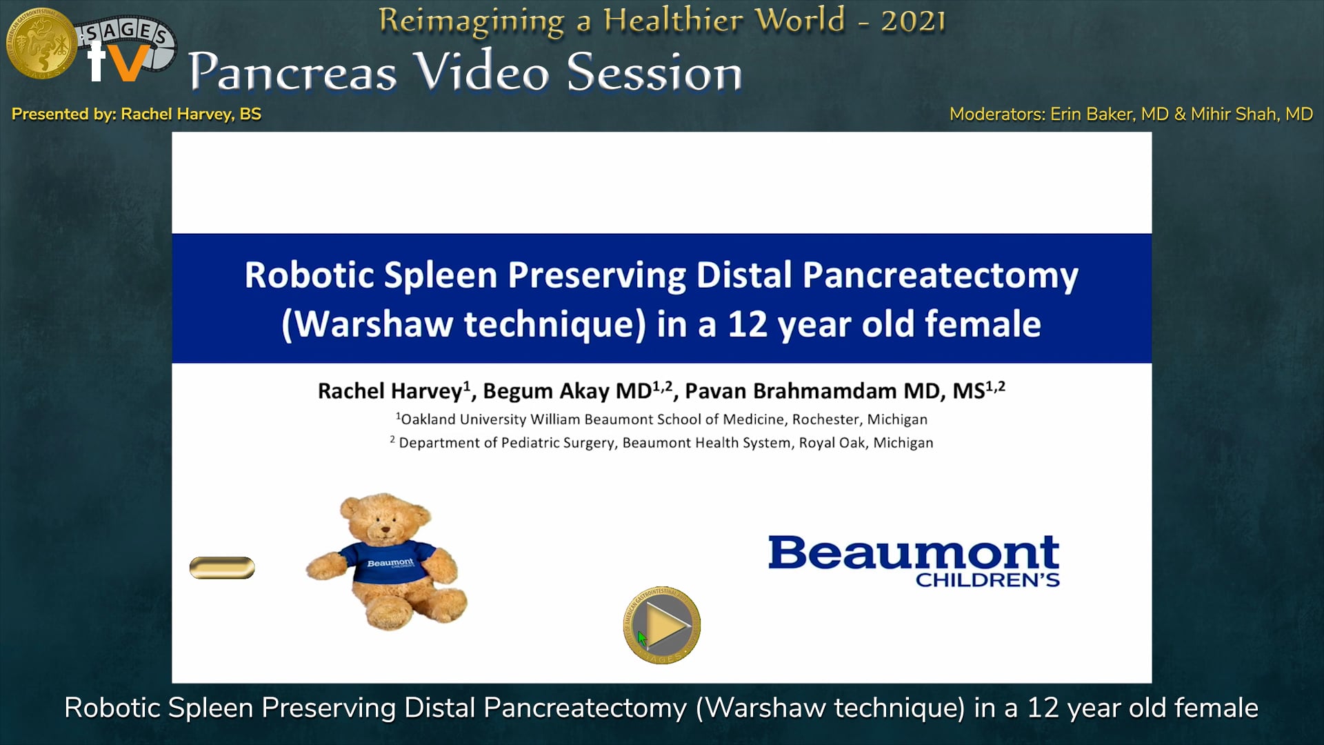 Robotic Spleen Preserving Distal Pancreatectomy (Warshaw technique) in ...