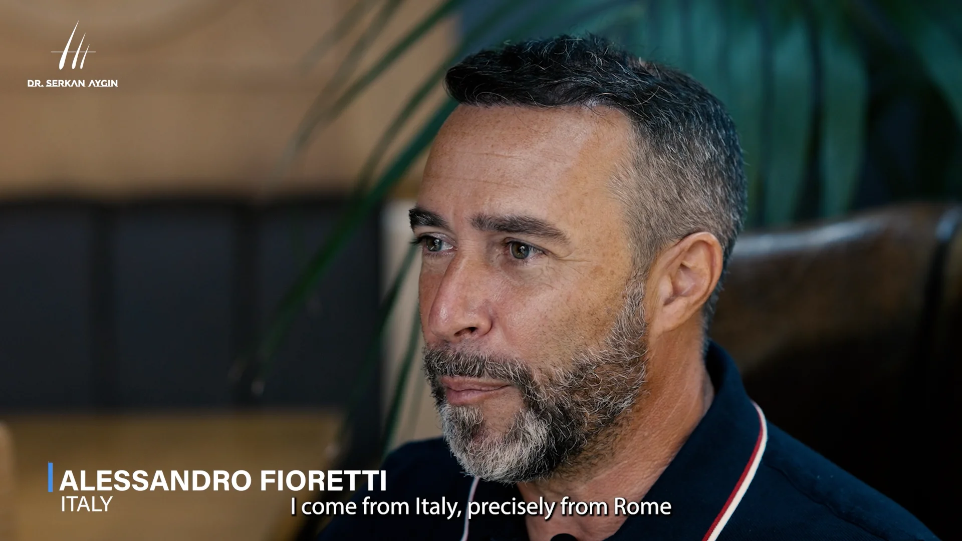 Alessandro Fioretti's Hair Transplant Journey on Vimeo
