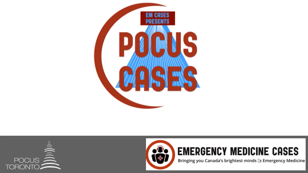 POCUS Cases 10 AAA - Accuracy, Limitation & Pitfalls of POCUS for AAA ...