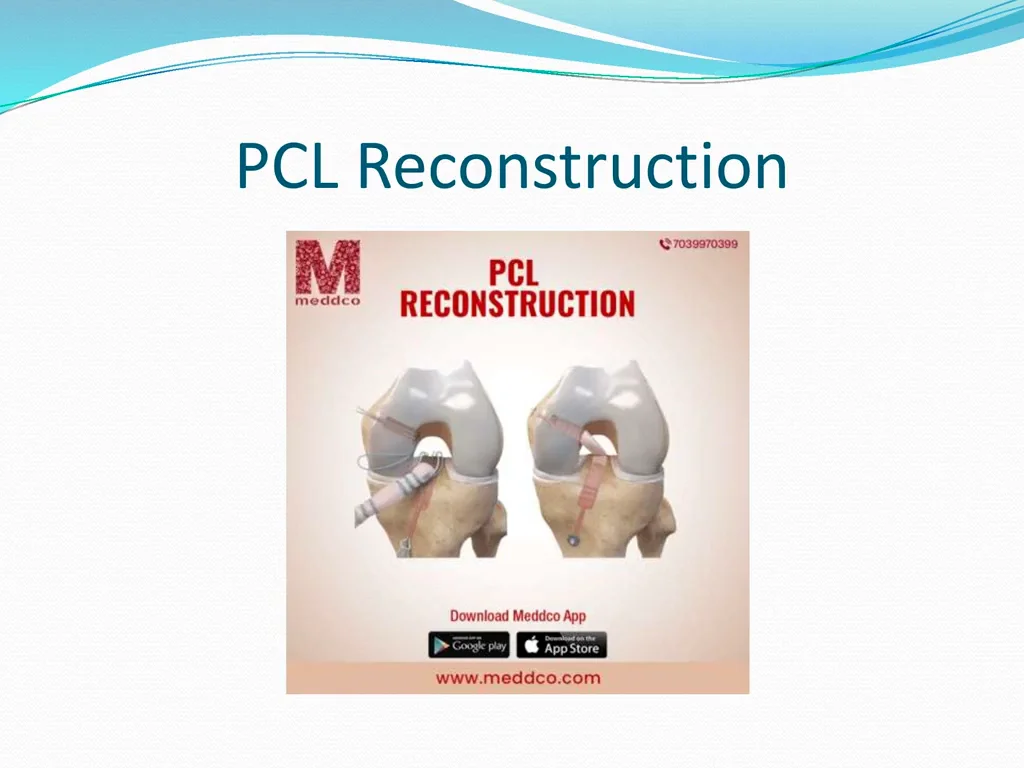 PCL Reconstruction ppt (1) on Vimeo