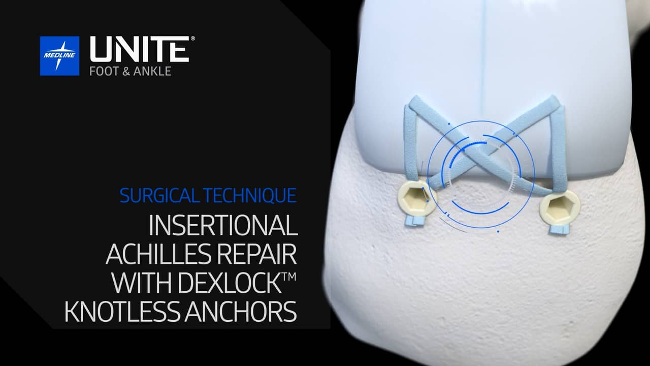 Insertional Achilles Repair with DEXLOCK™ Knotless Anchors Surgical ...