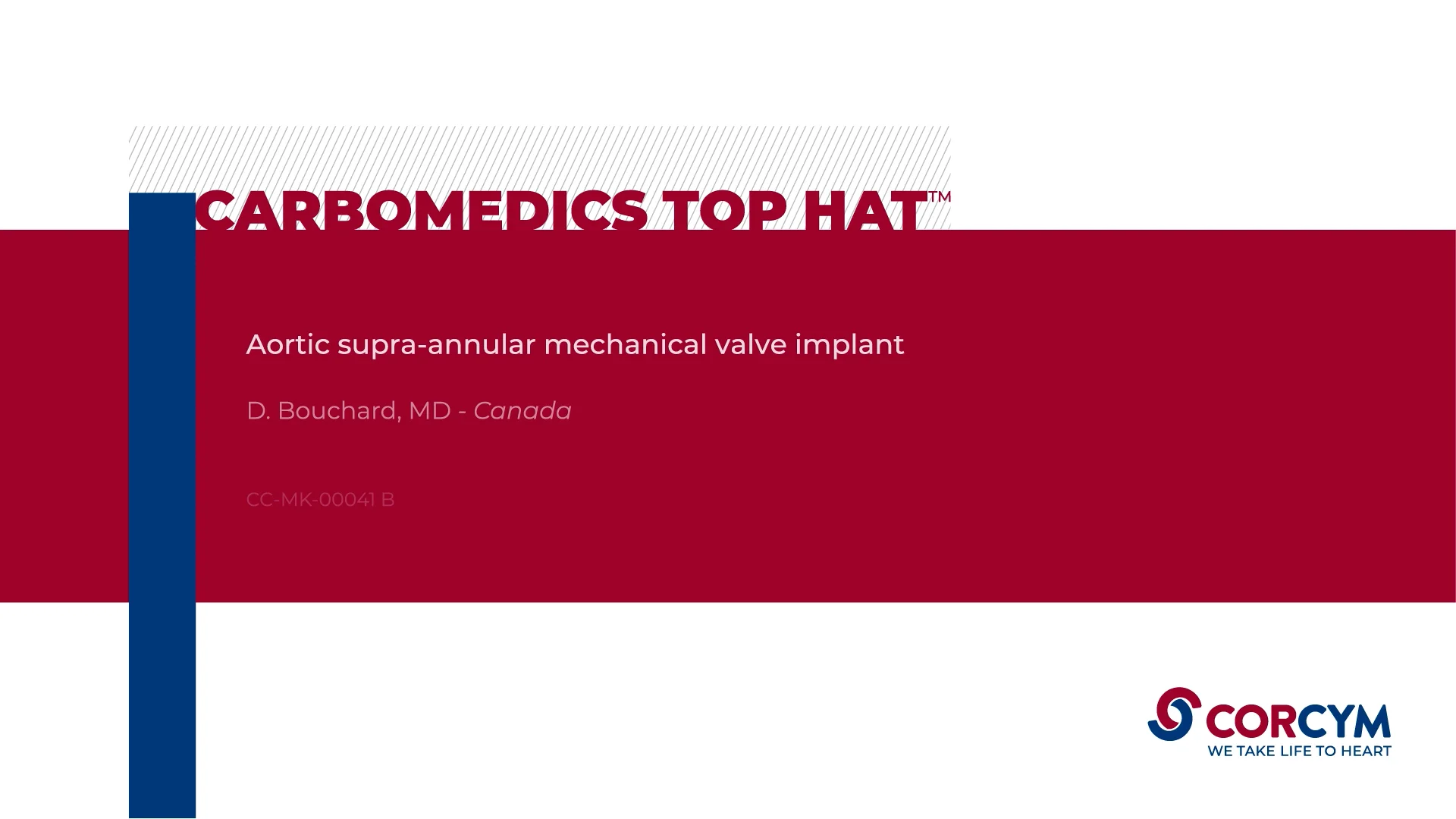 (CC-MK-00041 B) - Carbomedics Top Hat mechanical valve implant Video on ...