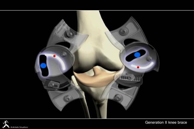 Generation II knee brace on Vimeo