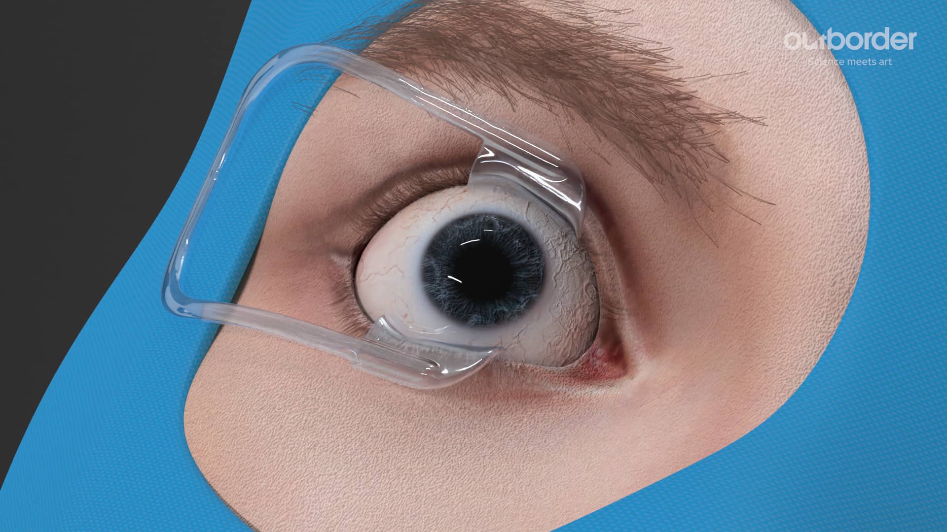 Ophthalmic medical device on Vimeo