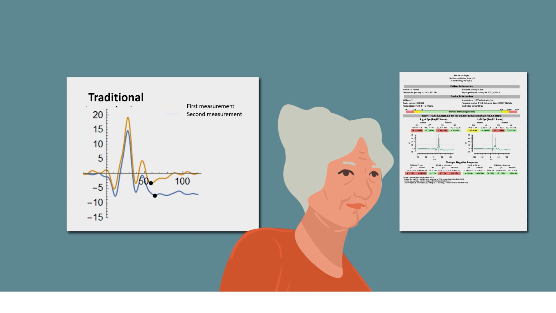 Improving glaucoma management with the RETeval ERG system on Vimeo