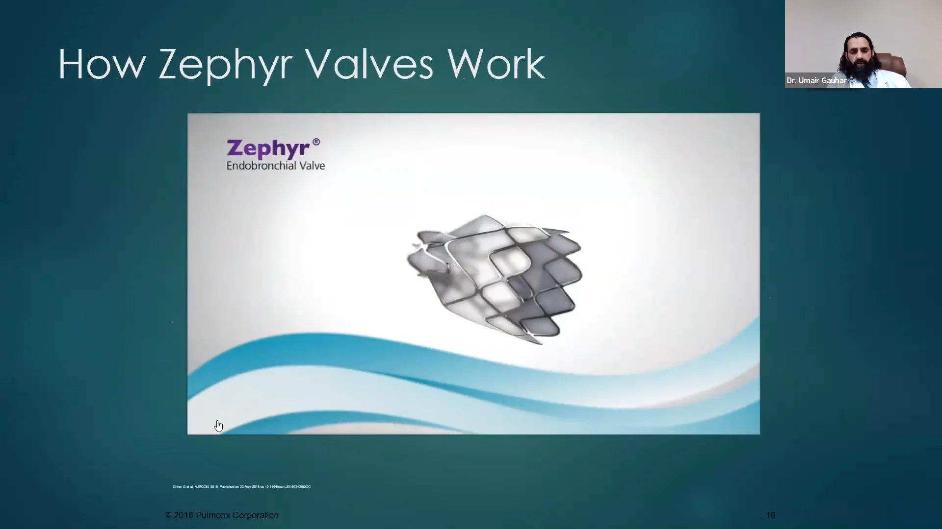 Zephyr Endobronchial Valves: A treatment to reduce hyperinflation in ...