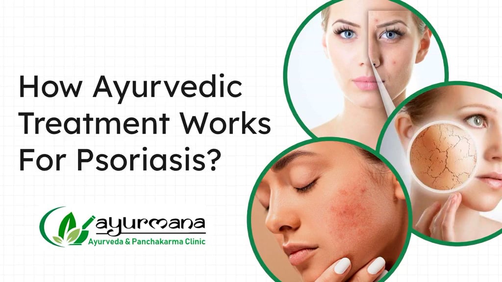 How Ayurvedic Treatment Works For Psoriasis? on Vimeo