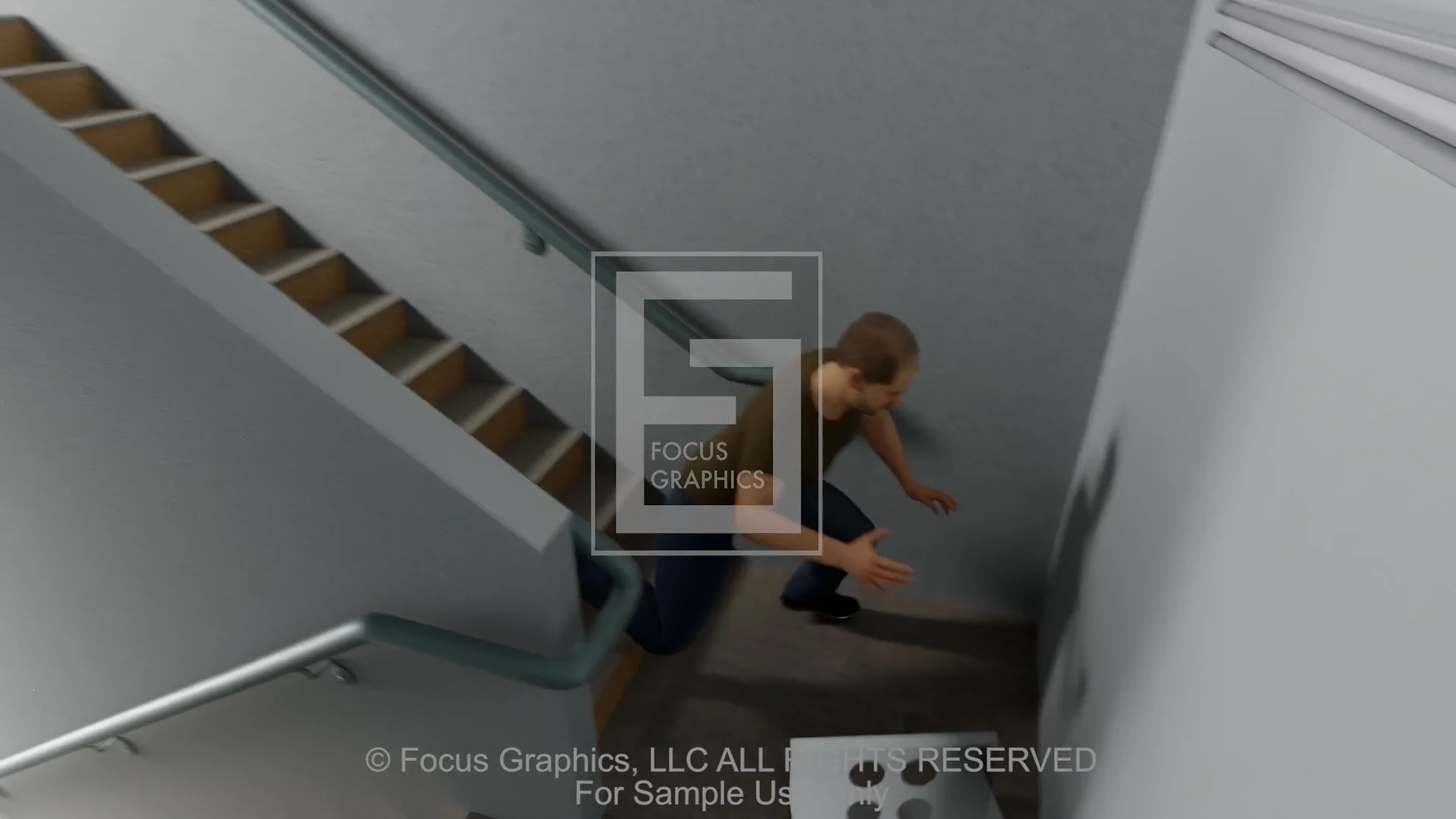 Code Violation Results in Fall Down Stairs and Traumatic Brain Injury on Vimeo