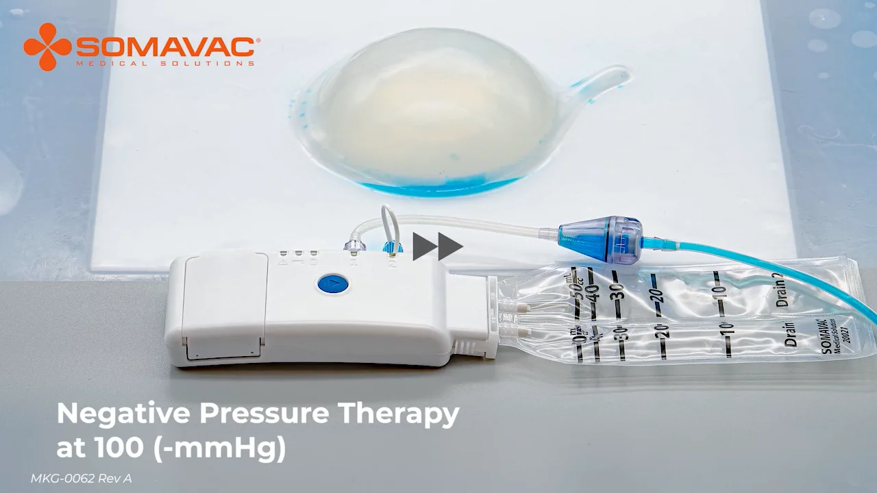 SOMAVAC SVS Negative Pressure Therapy