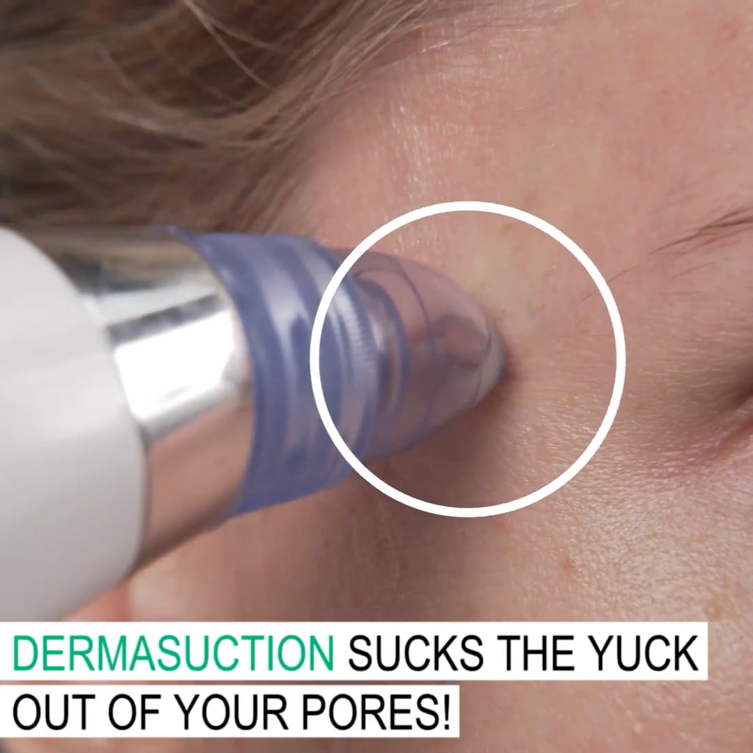 Y2Mateis - DermaSuction As Seen On TV Vacuum Blackhead Remover-TJt ...