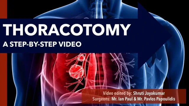 Posterolateral Thoracotomy