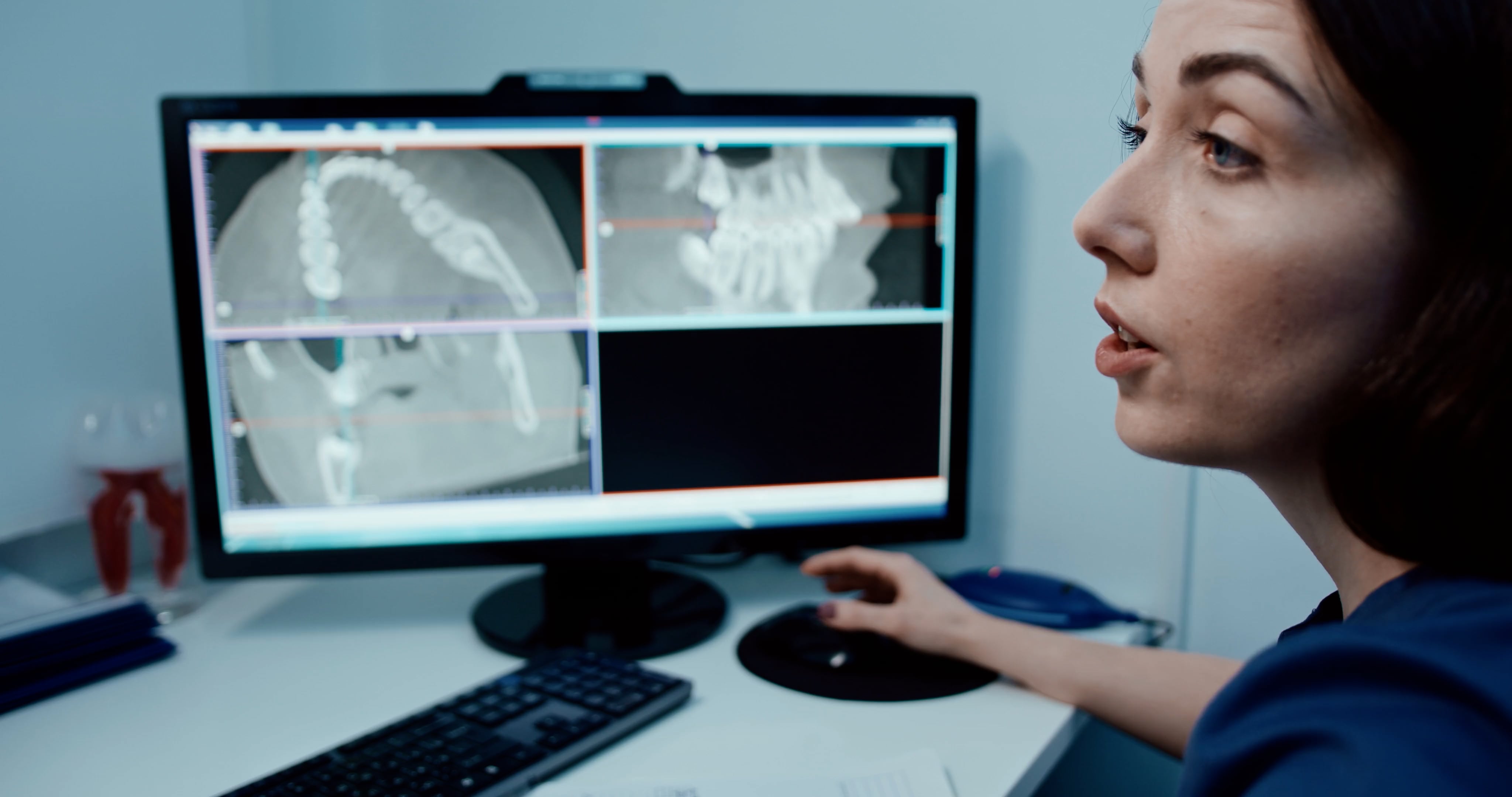 MEGADENT DENTAL SURGICAL GUIDES AND FULL MOUTH IMPLANT BASE RESTORATIONS