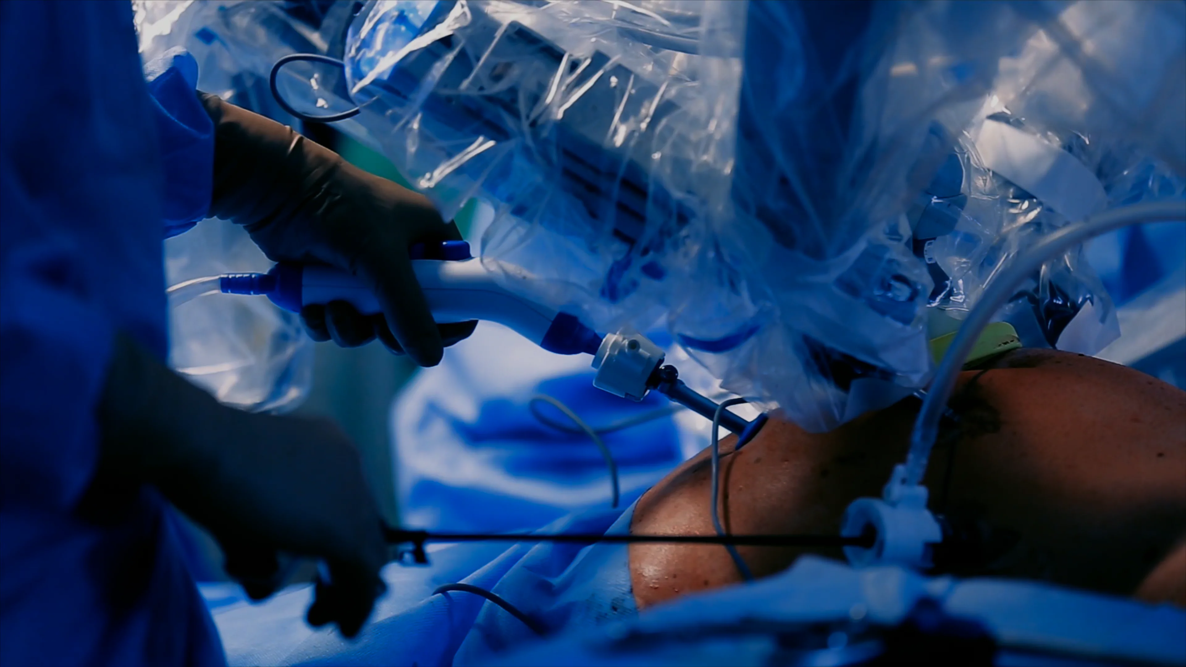 The Infinitus Advantage on Vimeo